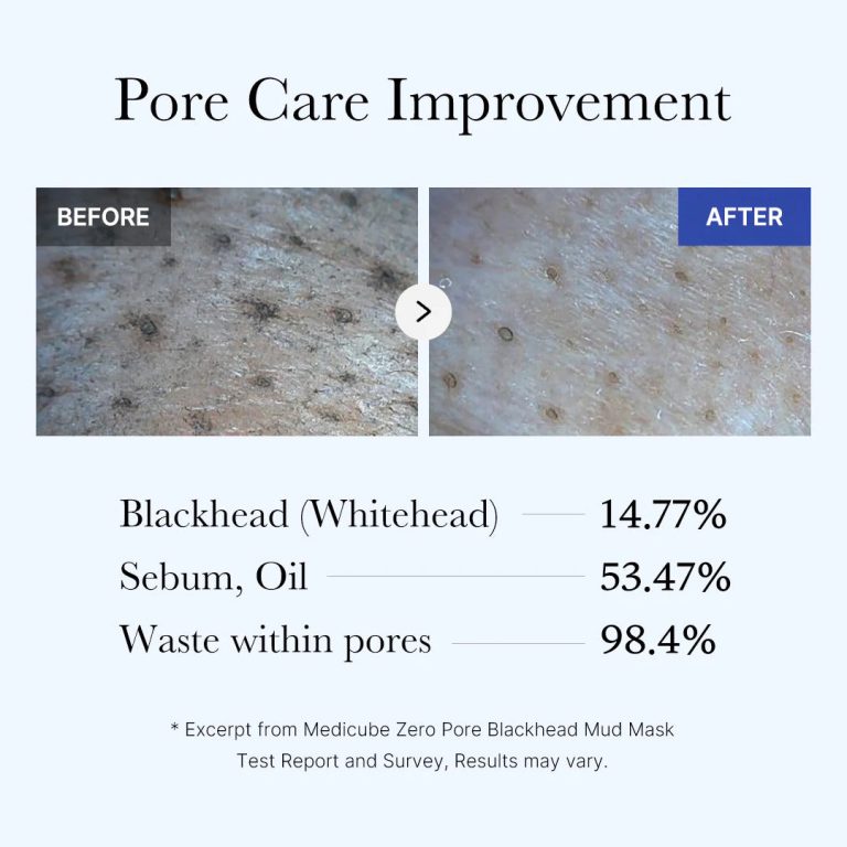 Medicube Zero Pore Blackhead Mud Mask | ES Beauty Closet Sri Lanka